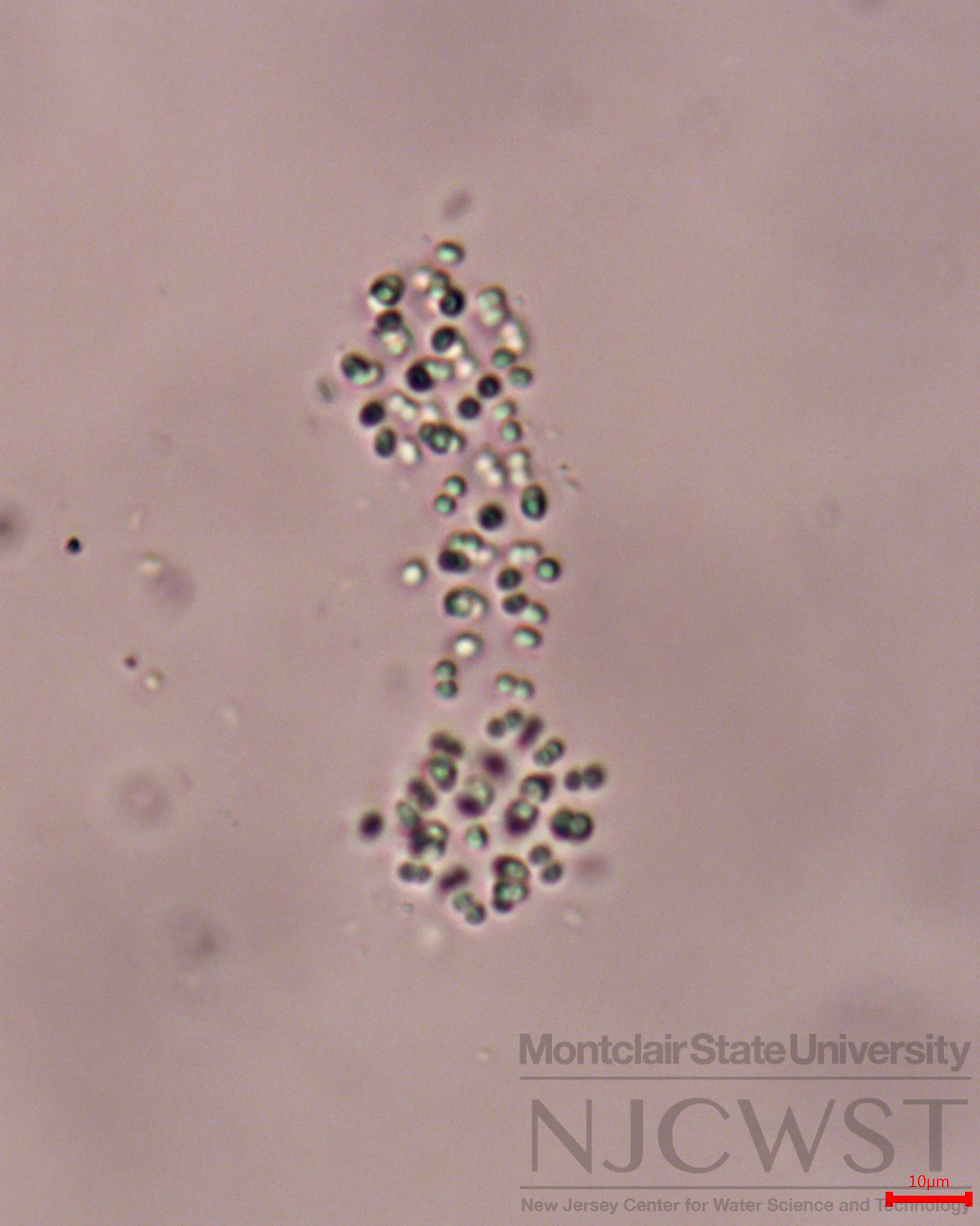 Aphanocapsa – New Jersey Center For Water Science And Technology ...