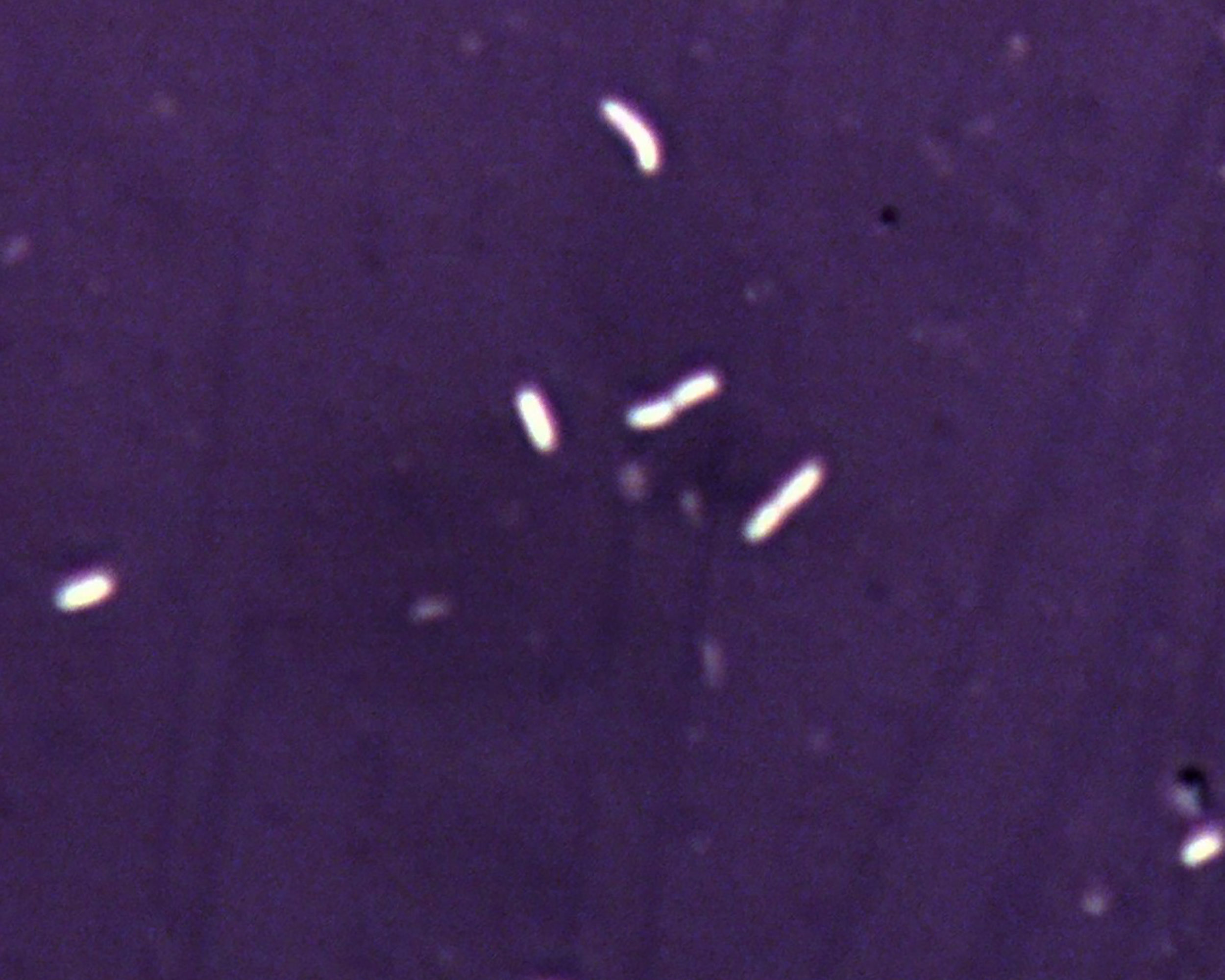 Coccoid Cyanobacteria – New Jersey Center For Water Science And ...